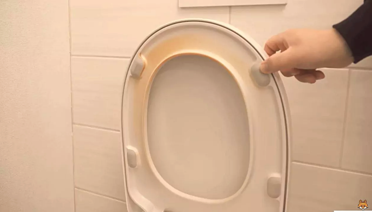 Wie entfernt man gelbe Flecken auf dem Toilettensitz? Die Verfärbung ... Wie entfernt man gelbe Flecken auf dem Toilettensitz? Die Verfärbung ...